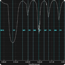 TESCAN AMBER 2: Automated FIB-SEM for TEM Prep & Nanoprototyping