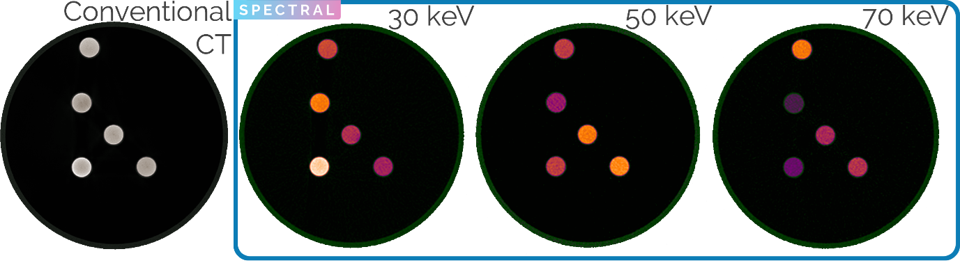 SPECTRAL CT revolutionizes micro-CT imaging